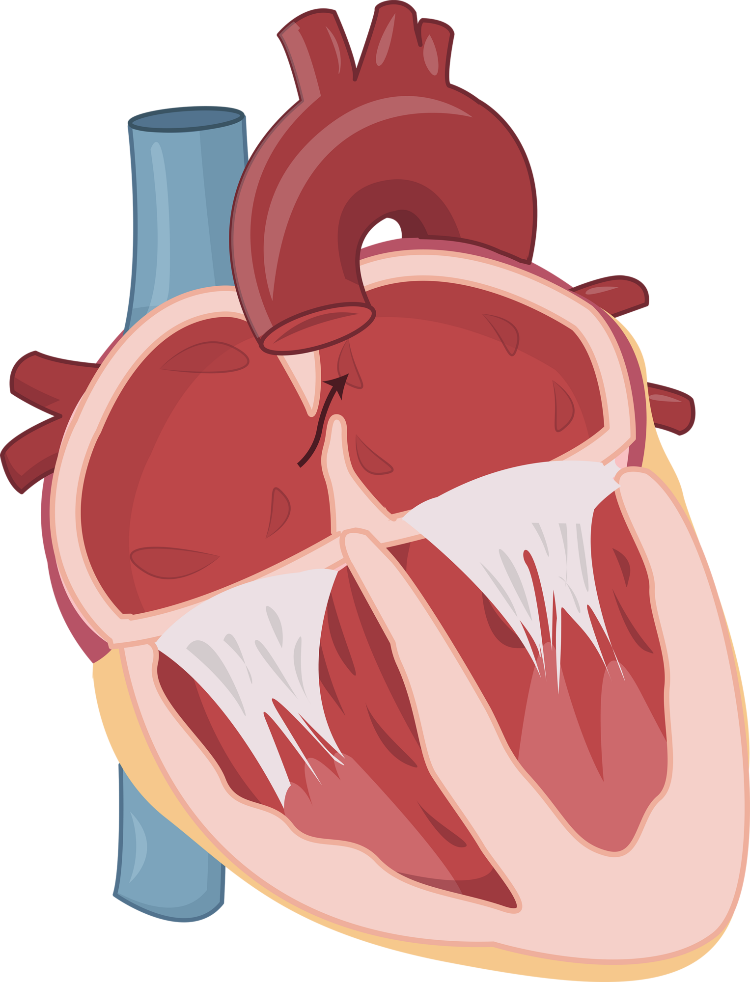 Forame Oval Patente (FOP): entenda condição caracterizada por “buraco ...